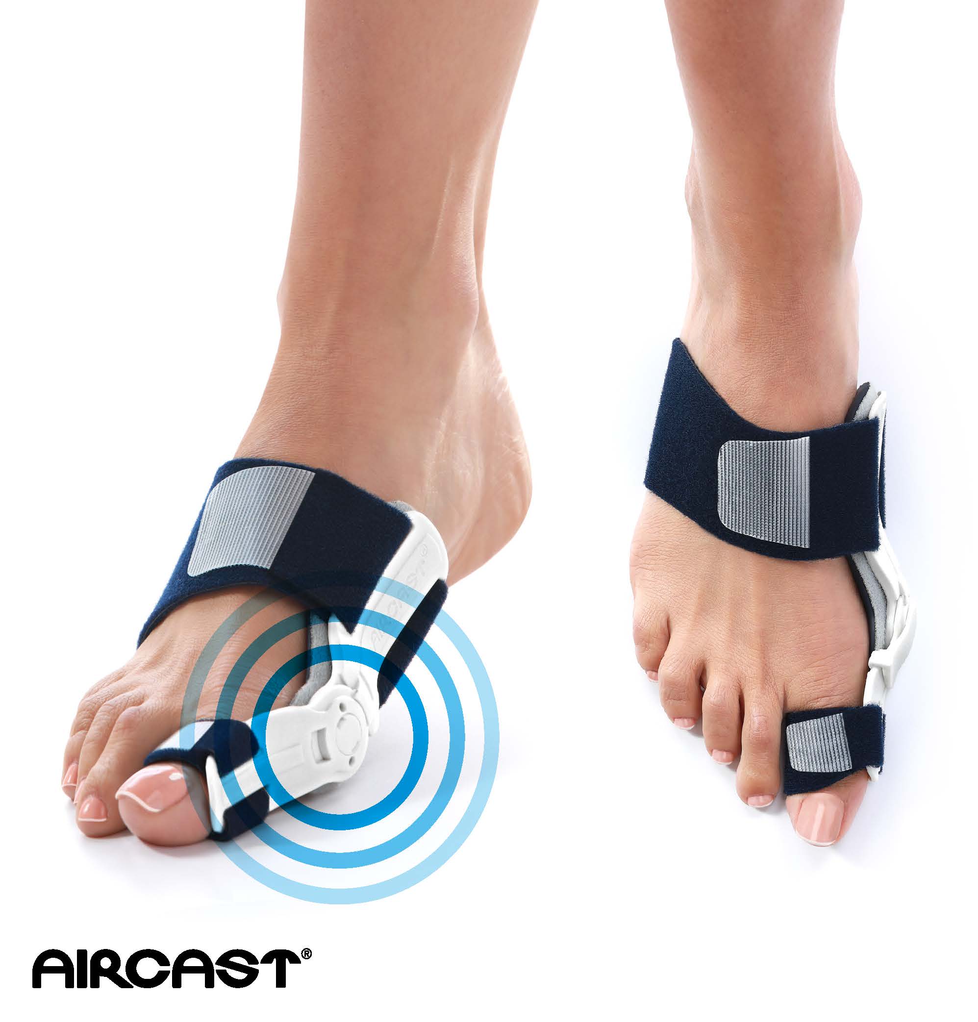 How a Splint Can Help Relieve Bunion Pain - Enovis